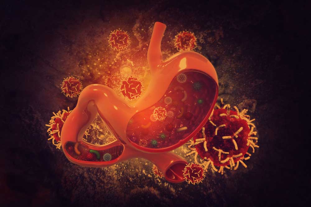 11 Warning Signs And Symptoms Of Stomach Cancer You Should Not Ignore